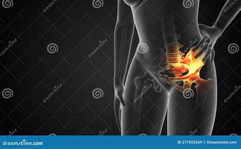 Pelvic Joint Pain Medical Concept Stock Illustration Illustration Of