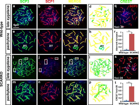Figure 1 From Androgen Receptor In Sertoli Cells Regulates Dna Double