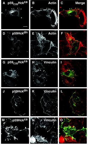 P59hck Isoform Induces F Actin Reorganization To Form Protrusions Of