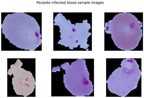 Github Kresnandika Malaria Cell Image Classification Cnn In This Kernel I Have Shown The
