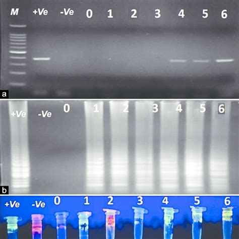 Sensitivity Evaluation Of Loop Mediated Isothermal Amplification Lamp