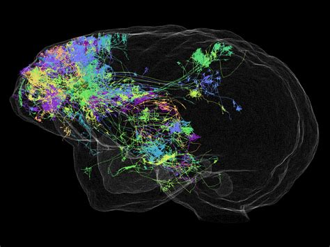 Digital Brain Cebsition