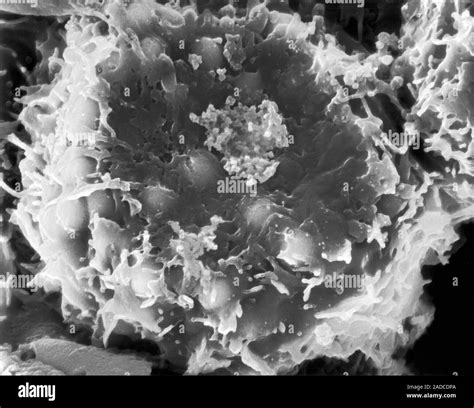Human T Lymphocyte With Htlv 1 Infection Scanning Electron Micrograph