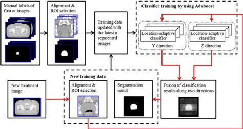 flowchart of the proposed patient specific prostate segmentation