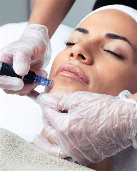 Microneedling Treatment For Skin Rejuvenation In Plantation Florida