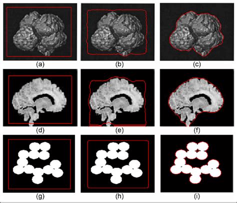 segmentation results of the gac model and the proposed model for the