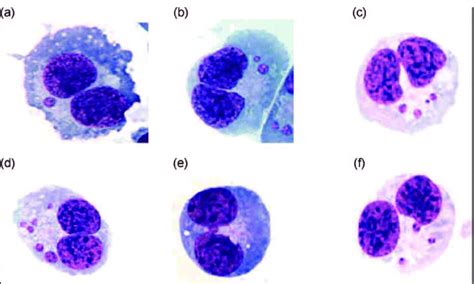A F Photomicrographs Of Typical Binucleated Cells Bn With