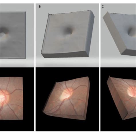 Upper Exported Obj Format 3d Model In The En Face Viewing Position