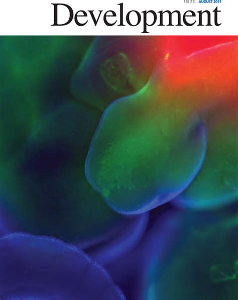 Endoderm Specification In Sea Urchins Development The Company Of Biologists