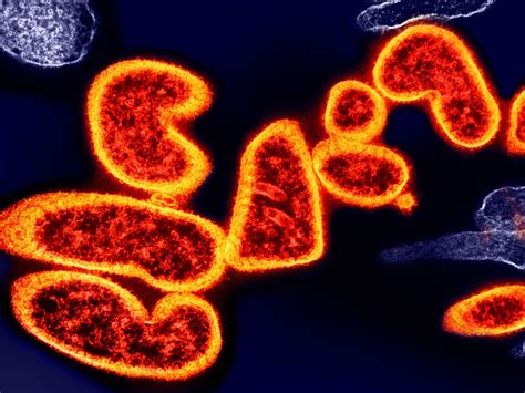 Qué Es Y Cómo Se Transmite El Peligroso Virus Nipah Que India Intenta