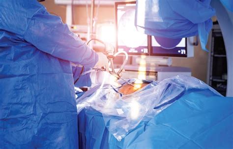 Spinal Fusion Part 2 Get Approach Technique Info Before Coding Surgery