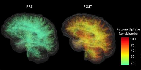 Whole‐brain White Matter Tractograms From A Sample Participant In The Download Scientific