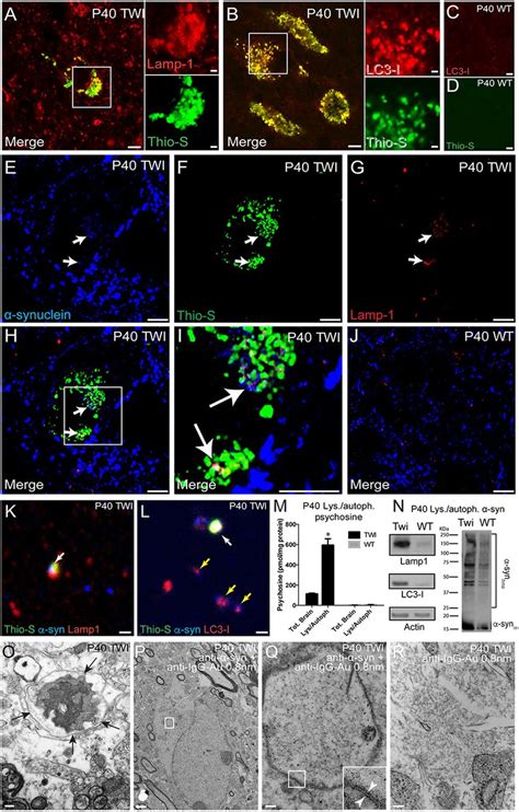 Psychosine And Synuclein Subcellular Localization In Vivo Download Scientific Diagram