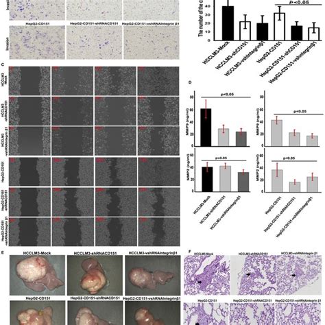 Correlations Of Cd151 And Integrin β1 Expression With Download Table