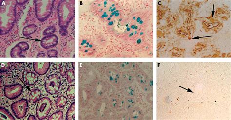 Serial Sections Of Formalin Fixed Paraffin Embedded Biopsy Tissue From Download Scientific
