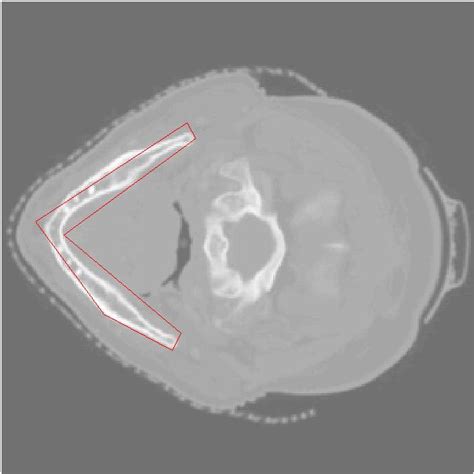 2009 Summer Project Week Adaptive Rt Namic Wiki