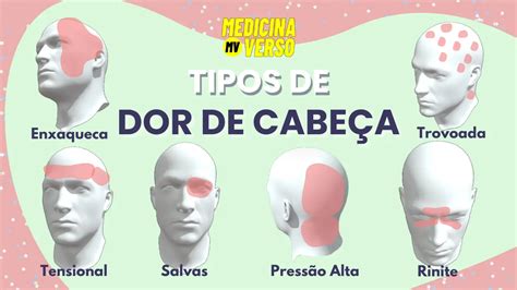 Tipos De Dores De Cabeca Diferença Entre Dor De Cabeça Comum E