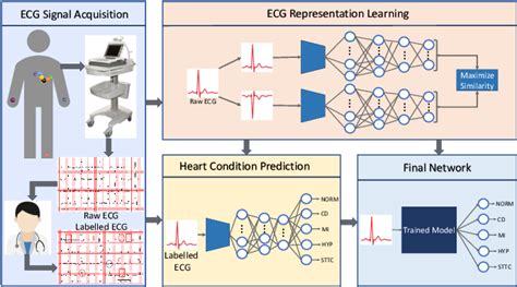 Figure 1 From Analysis Of Augmentations For Contrastive Ecg Representation Learning Semantic