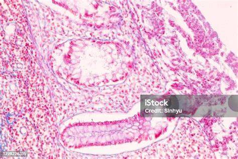 Tissue Of Small Intestine And Vermiform Appendix Human Under The