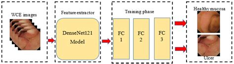 Schematics Representation Of Pre Trained Model For Ulcer Download