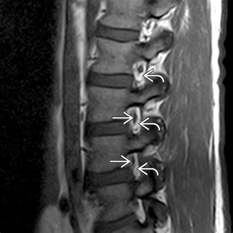 Selective Nerve Root Block Lumbar Spine Clinical Tree