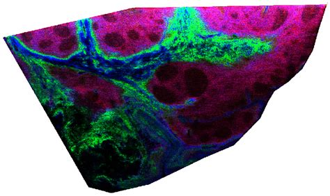 Introduction To Mass Spectrometry Imaging Data Analysis Aspect Analytics Bring Your Spatial