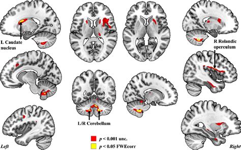 Operculum Brain Of The L Operculum Brain Of The L