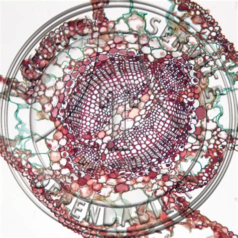 Potato Scab Prepared Microscope Slide 60 Off