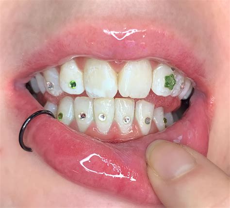 Tooth Gems All About Tooth Jewellery — The Gemist Hub