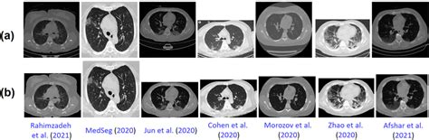 a an example lung ct frame from the seven open source datasets