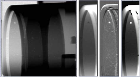 Figure 1 From Defect Detection Method In Digital Radiography For