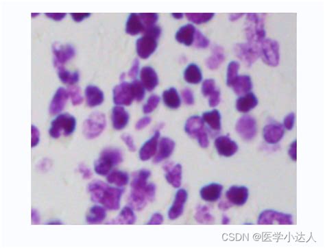 Python Unet 医学图像分割，医学细胞分割，unet医学图像处理，语义分割unet代码 Csdn博客
