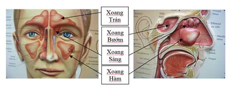 Giải Thích Viêm Xoang đa Cấp Là Gì Nguyên Nhân Và Biểu Hiện