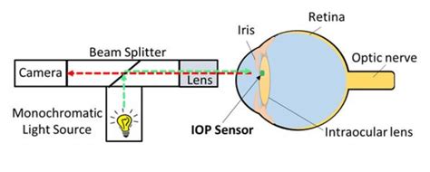 Optical Intraocular Pressure Measurement System With Implanted Sensor Download Scientific