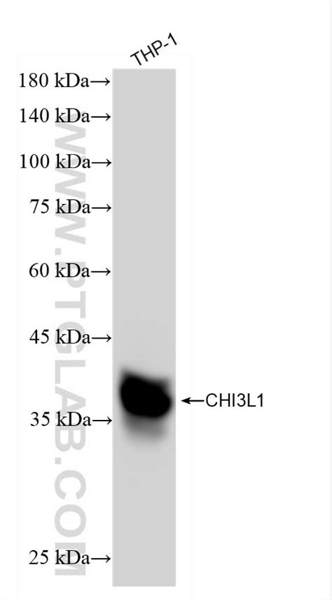 Chi3l1 Recombinant Monoclonal Antibody 240691f11 83685 4 Rr