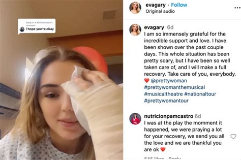 Pretty Woman Actress Suffers Multiple Injuries After Fall Eva Gary Speaks Out