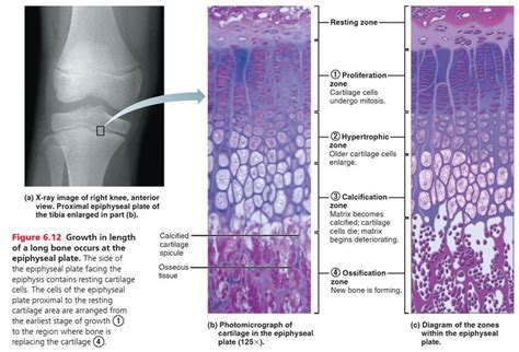 What Is A Epiphyseal Plate At Delbert Sanders Blog