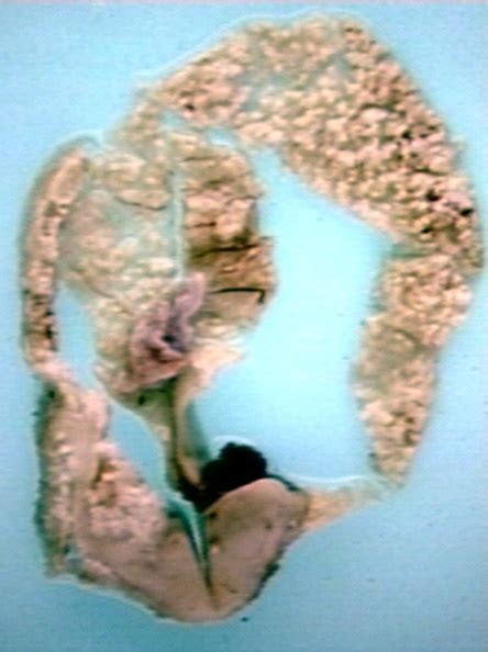 00232990 Peir Digital Library