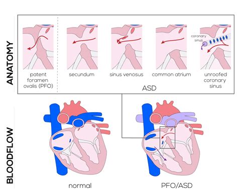 Interatrial Septum