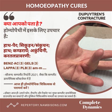 Homeo Complete Dynamics Software India डुप्यूट्रेन के संकुचन के लिए होम्योपैथिक उपचार