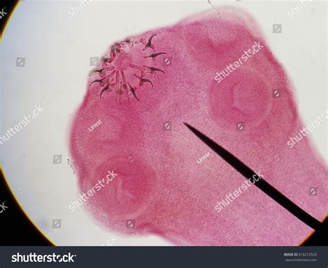 Taenia Solium Scolex
