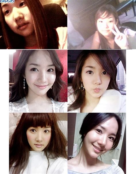 연예인 성형전후 네이버 블로그