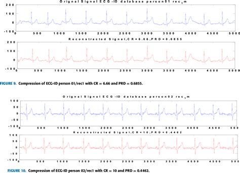 Figure 10 From An Energy Efficient Compression Algorithm Of Ecg Signals In Remote Healthcare