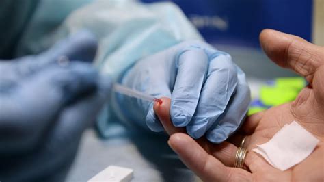 В Подмосковье сообщили о снижении заболеваемости ВИЧ инфекцией — РТ на русском