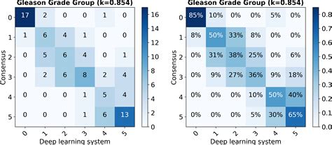 Automated Gleason Grading Of Prostate Biopsies Using Deep Learning Deepai
