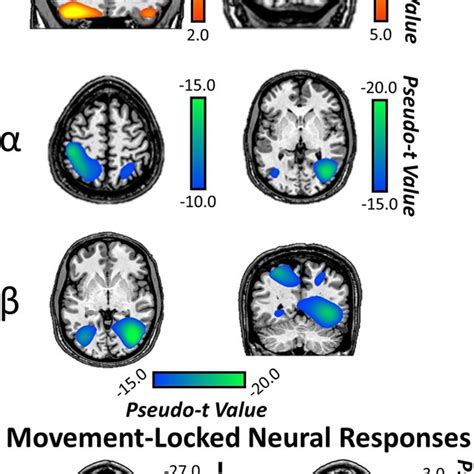 Cue‐ And Movement‐locked Oscillatory Activity During Target Processing