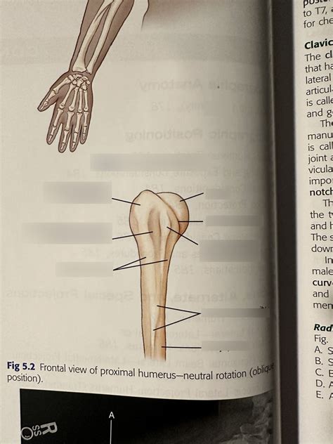 Frontal View Proximal Humerus Diagram Quizlet