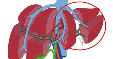 내 몸에 맞는 간 찾기 어렵다면… 작은 간 이식해 키워라