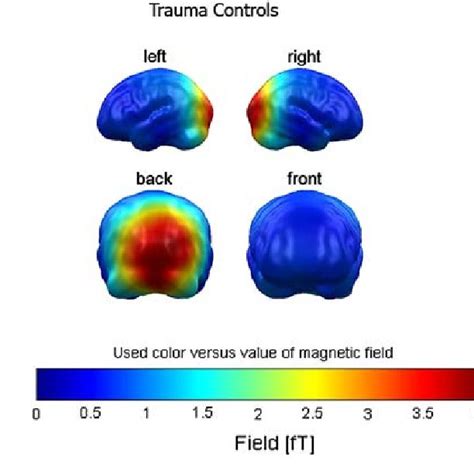 Topographical Brain Maps Showing Cortical Source Activity Following The Download Scientific