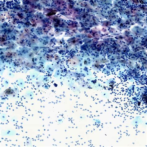 Crash On Stiching · Issue 3 · Usnistgovmist · Github